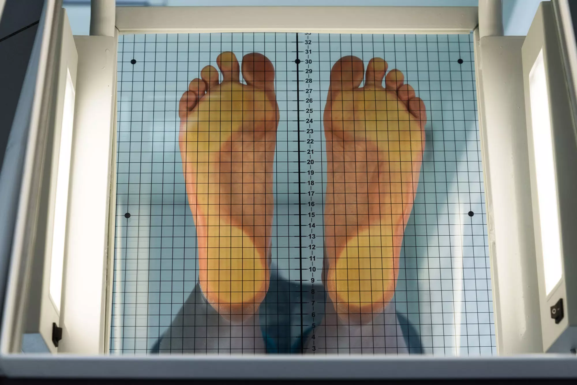 um aparelho especial para determinar pés chatos. o cirurgião ortopedista avalia a distribuição de carga dos pés no consultório do ortopedista