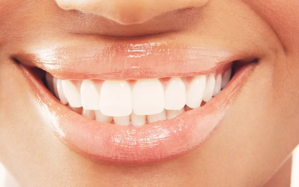 प्राकृतिक दांतों का सफेद होना