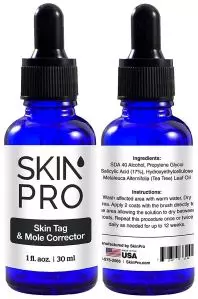 fjern skin tags derhjemme skinpro