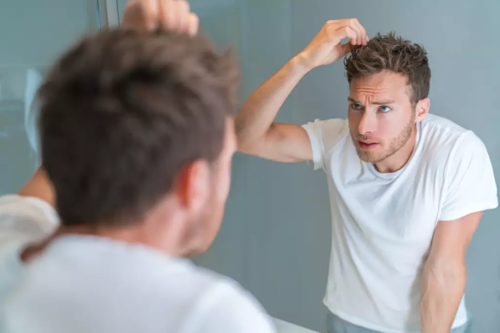Plaukų slinkimo mitai