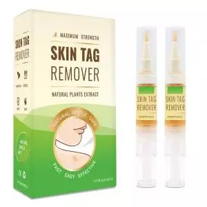 Ulensy Skin Tag Remover
