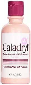 痱子治疗 caladryl