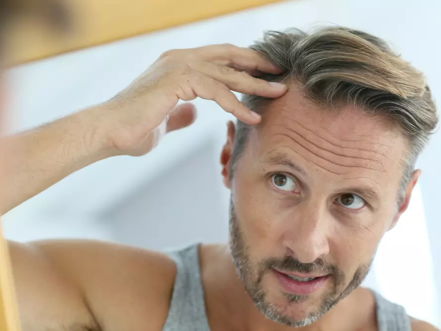 Balding Banes: Saç tökülməsi ilə mübarizə üçün 5 ən yaxşı təbii DHT blokerləri